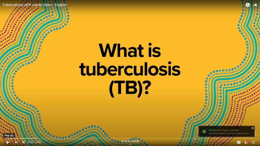 Tuberculosis – AHCWA