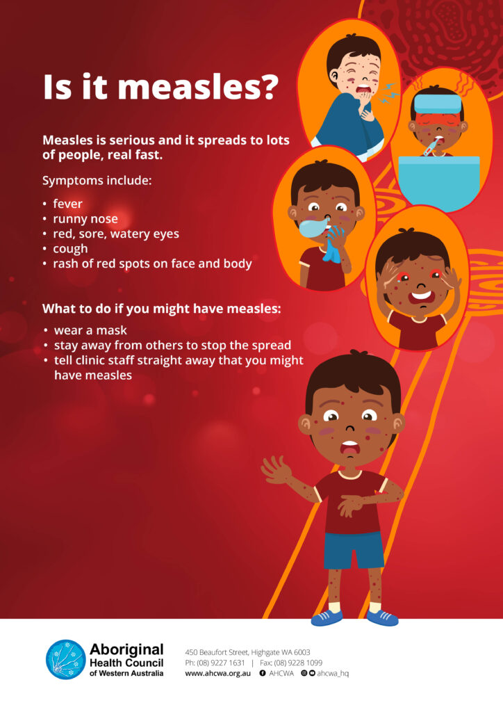 Measles – AHCWA